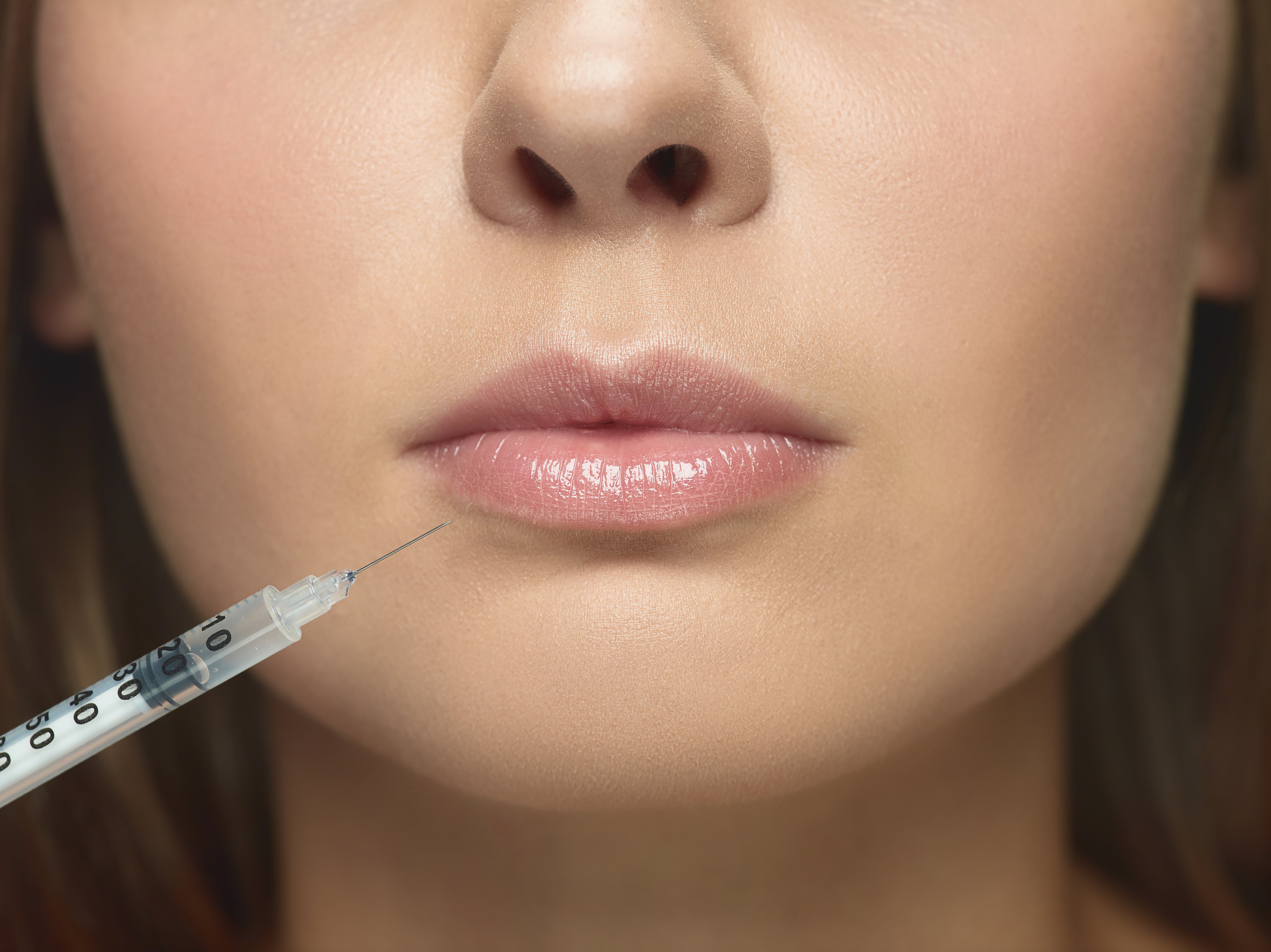 Relleno de Labios - Perfilado de Labios – Clínica Globalmedic